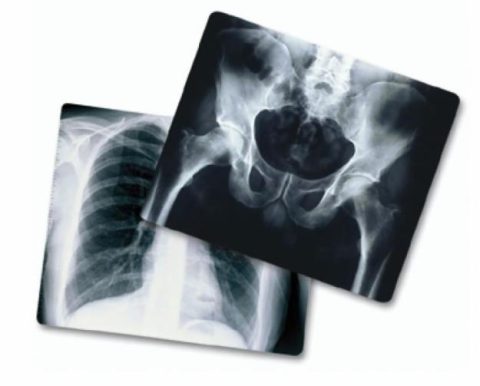 Home - Xray Recovery